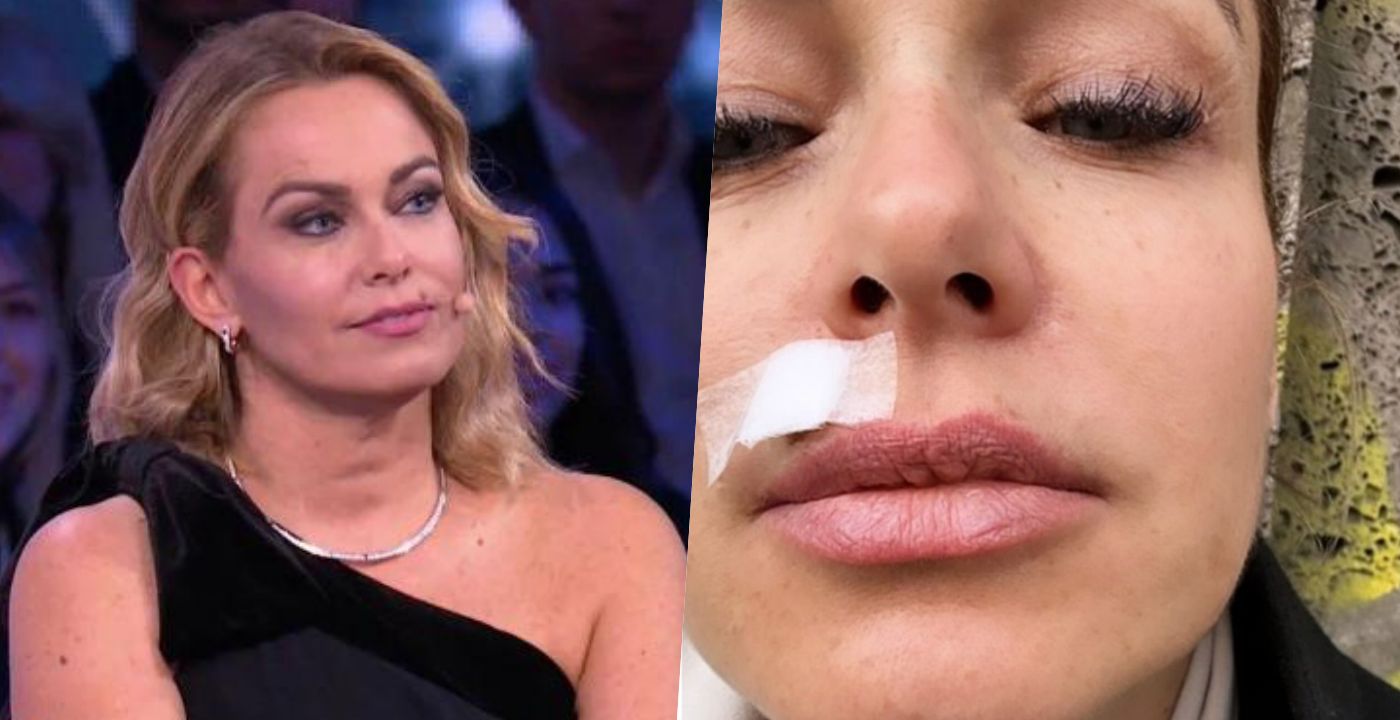Sonia Bruganelli, parla il medico che le ha tolto il neo Sonia Bruganelli, parla il medico che le ha tolto il neo