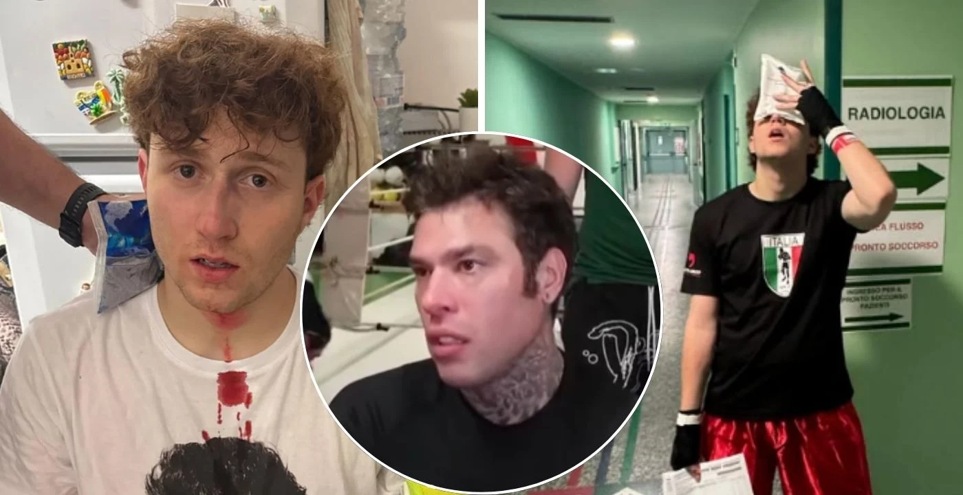 Fedez fa male a Il Rosso sul ring per sbaglio: cosa sta succedendo